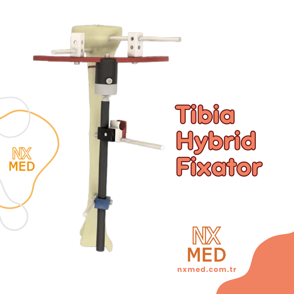 Large External Fixator Packs - NX-MED
